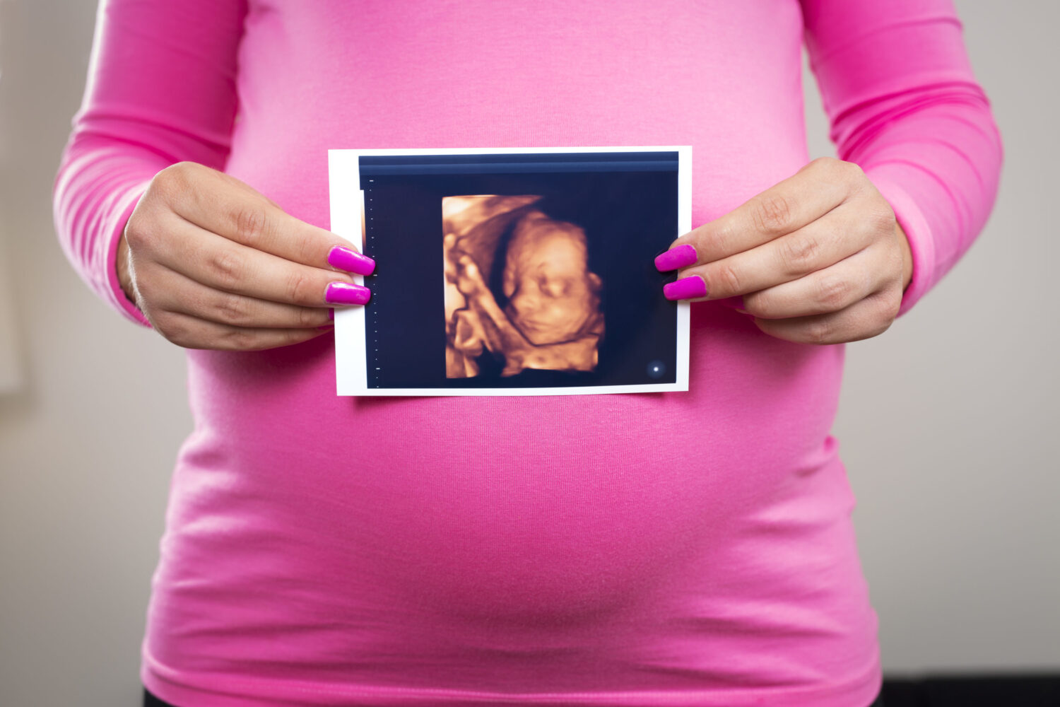 Packages - 3D | 4D Ultrasound- Perth